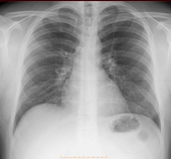 Radiologia a Domicilio radiografia TORACE #RestateACasa Veniamo NOI da VOI